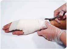 Scarban – Prävention und Narbentherapie